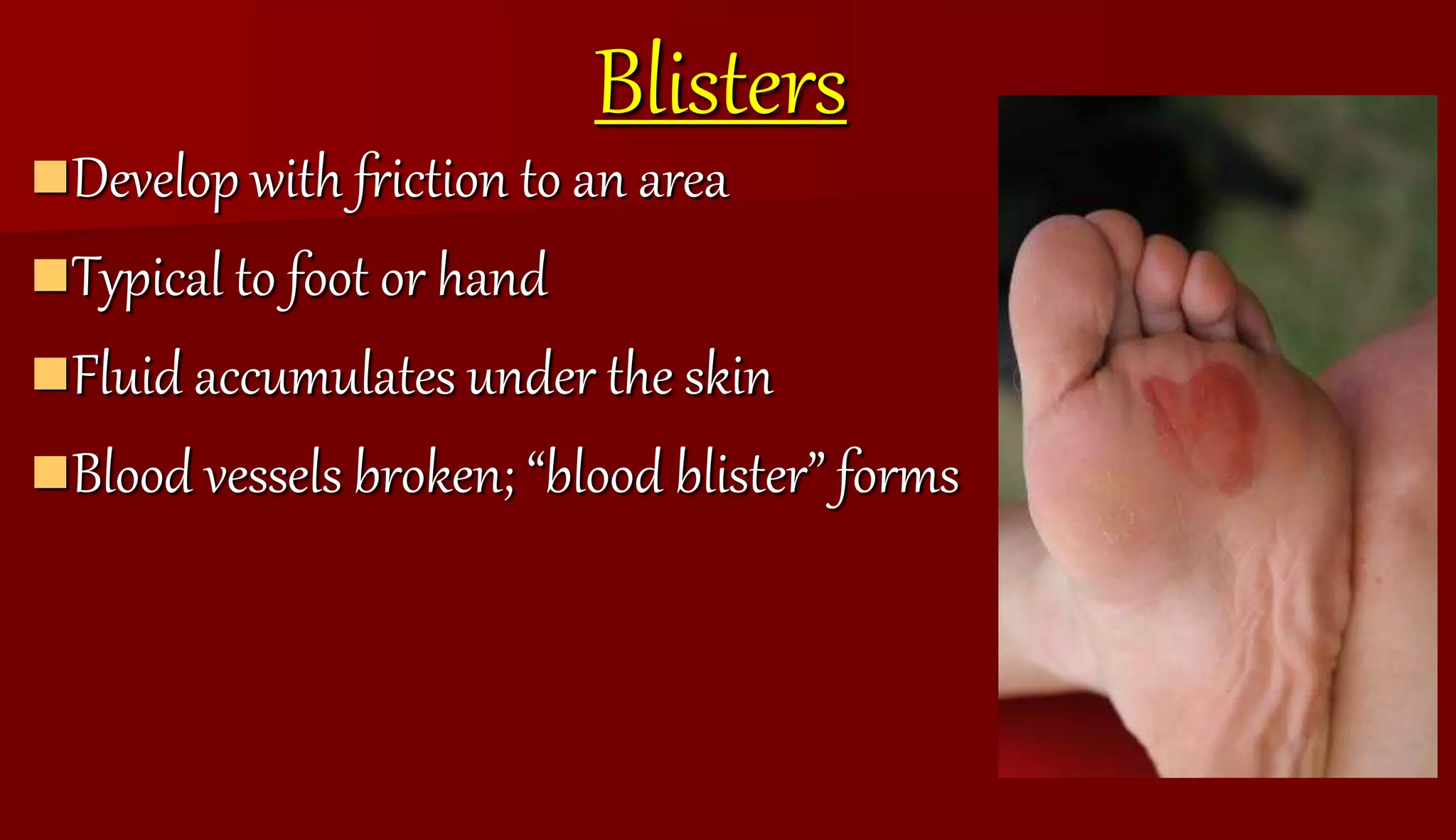 Classification of wounds | PPT | First Aid | Injuries