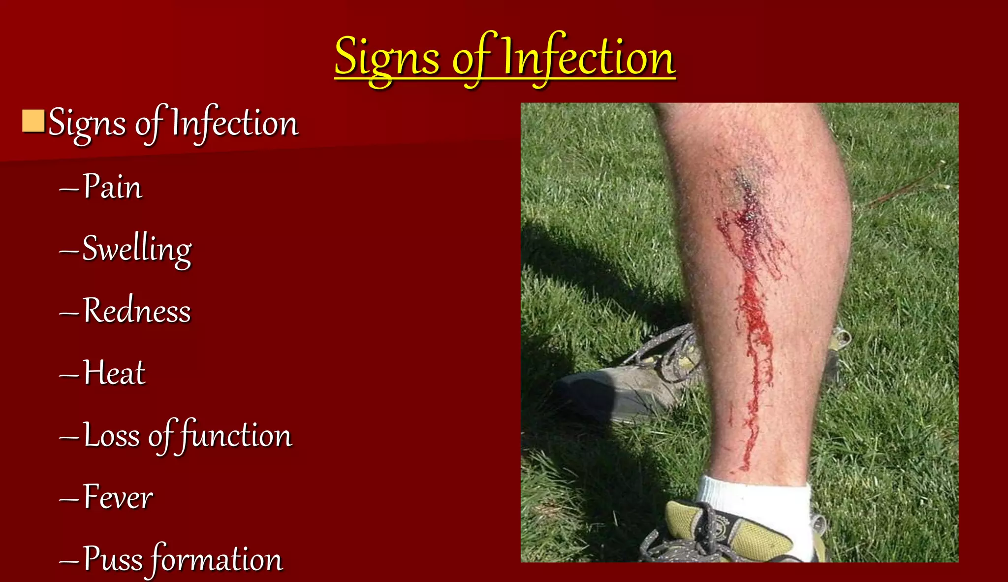 Classification of wounds | PPT | First Aid | Injuries