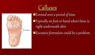 Classification of wounds | PPT | First Aid | Injuries