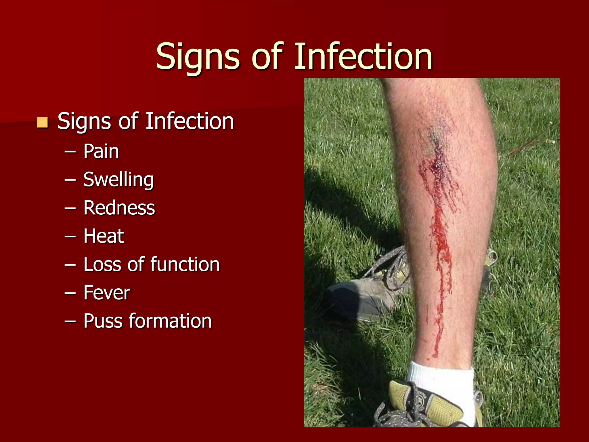 Classification of Wounds.ppt