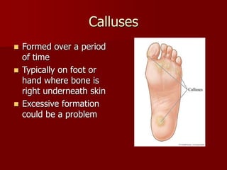 Classification of Wounds.ppt