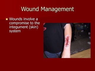 Classification of Wounds.ppt