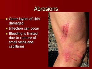 Classification of Wounds.ppt