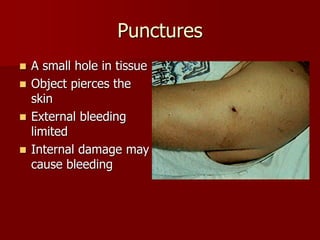 Classification of Wounds.ppt