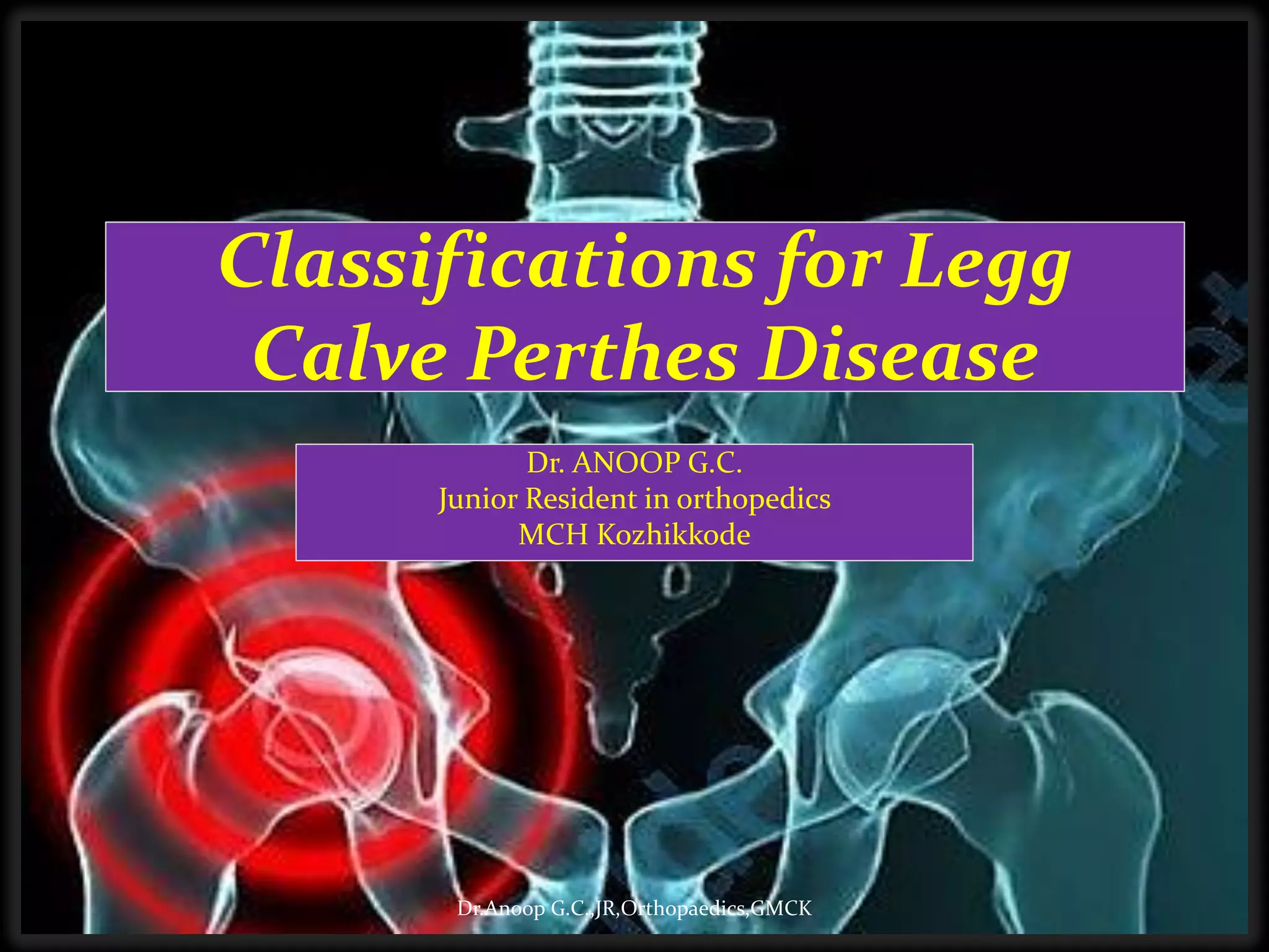 Classification perthes Disease | PDF