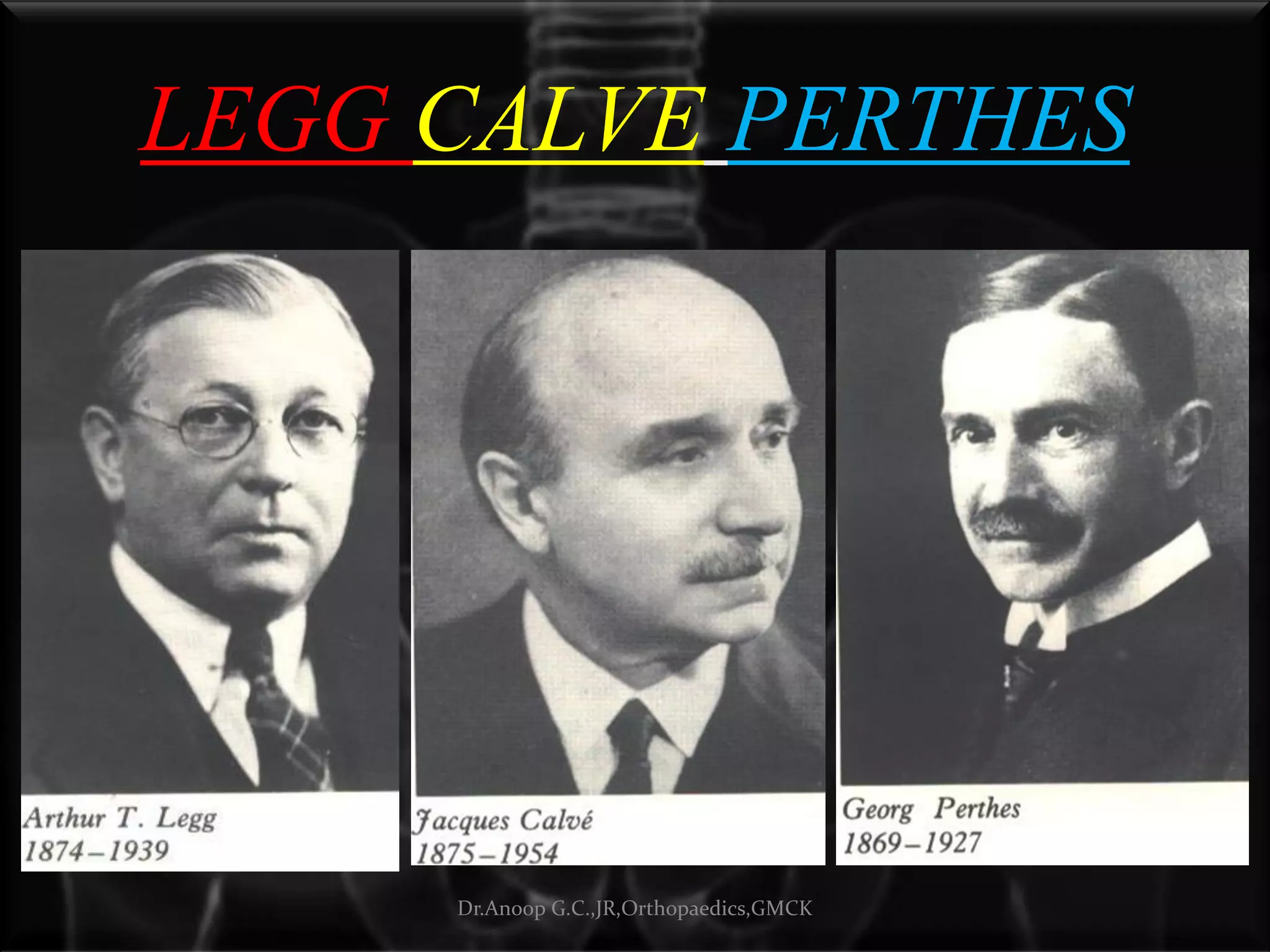 Classification perthes Disease | PDF