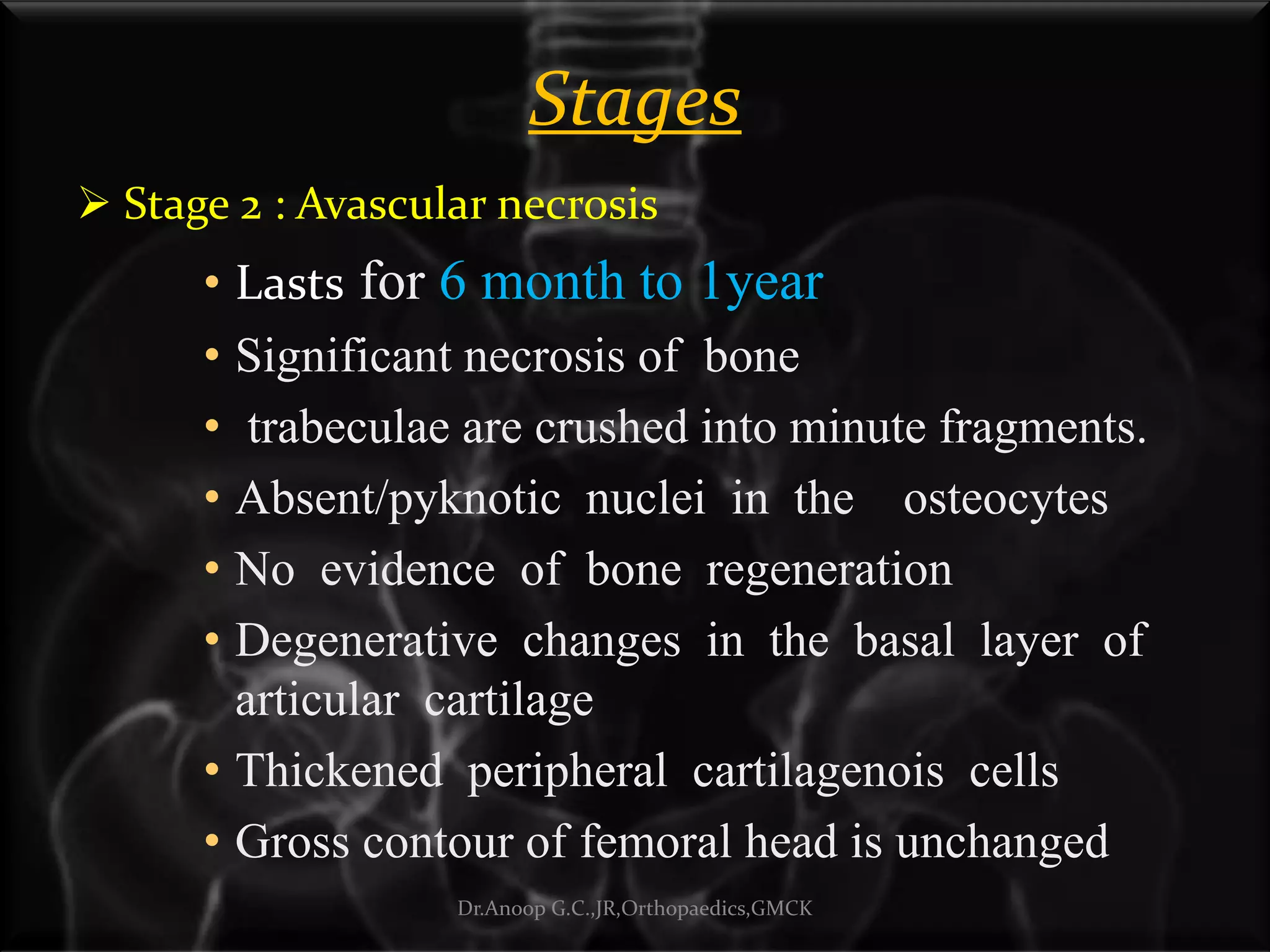 Classification perthes Disease | PDF