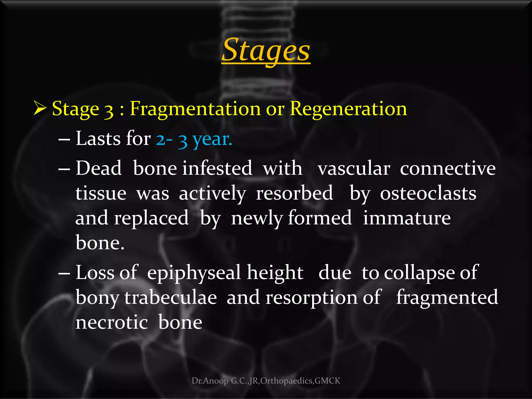 Classification perthes Disease | PDF