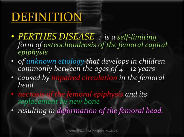 Classification perthes Disease | PDF
