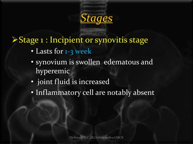Classification perthes Disease | PDF