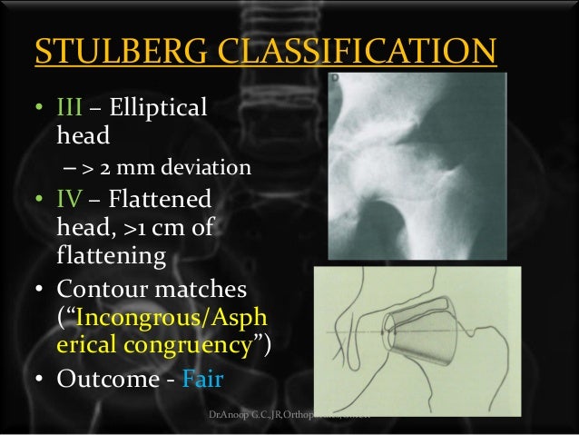 Classification perthes Disease