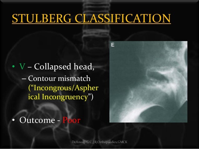 Classification perthes Disease