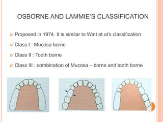classification RPD.pptx
