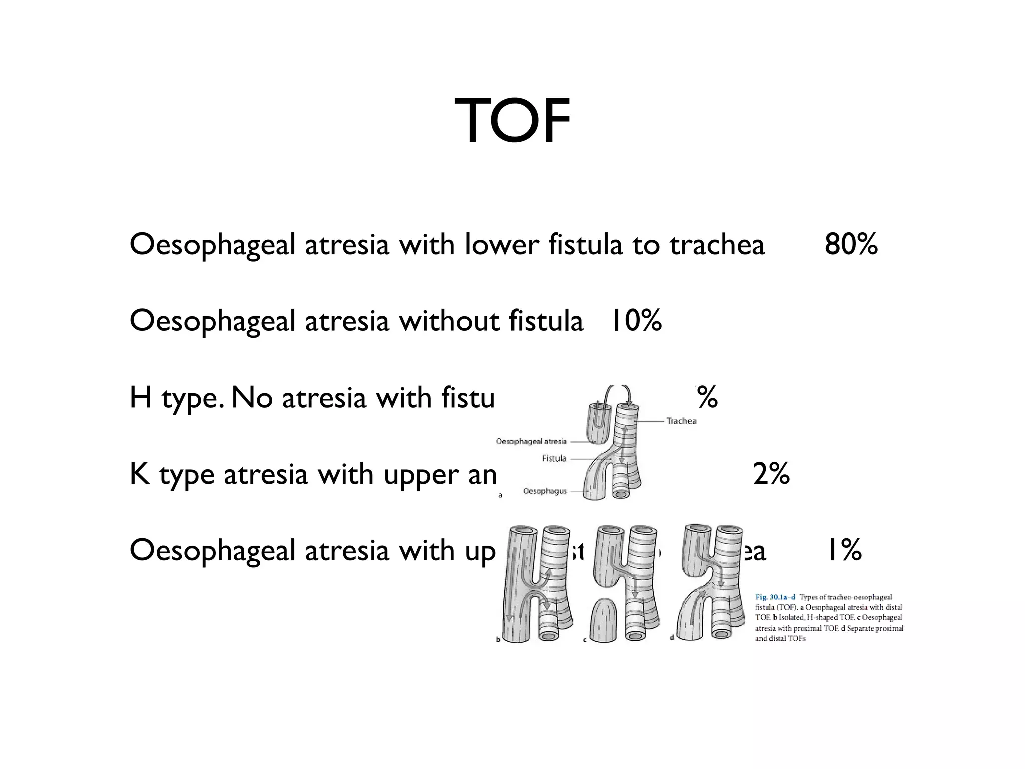 Classifications in ent | PPT