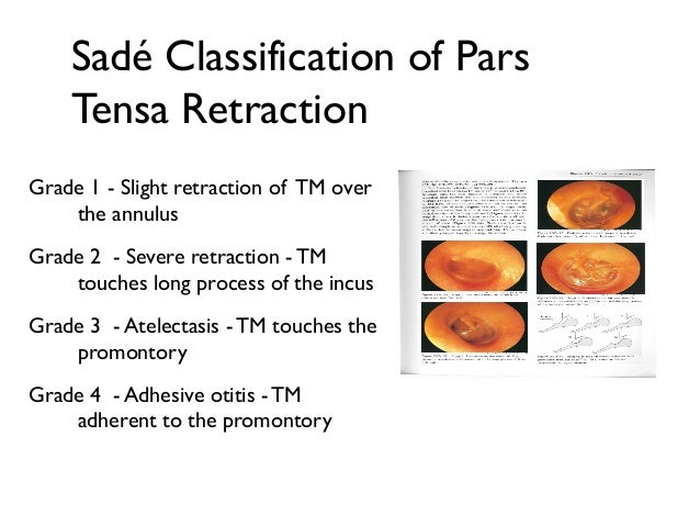 Classifications in ent
