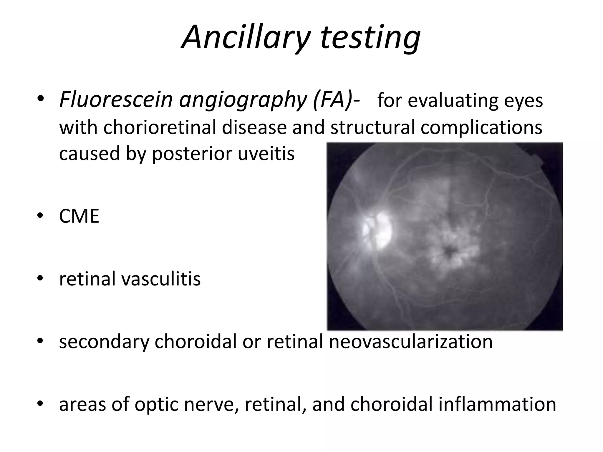 Classifications of etio pathogenesis of uveitis, anterior uveitis- dr.k ...