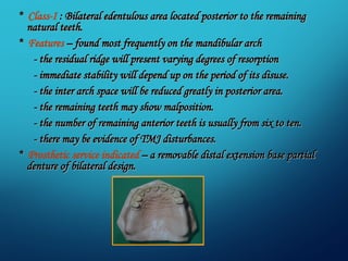 Classification System for The Partially Edentulous Arches (1).ppt