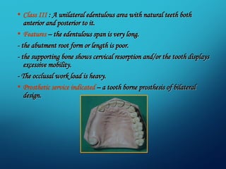 Classification System for The Partially Edentulous Arches (1).ppt