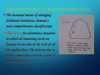 Classification System for The Partially Edentulous Arches (1).ppt