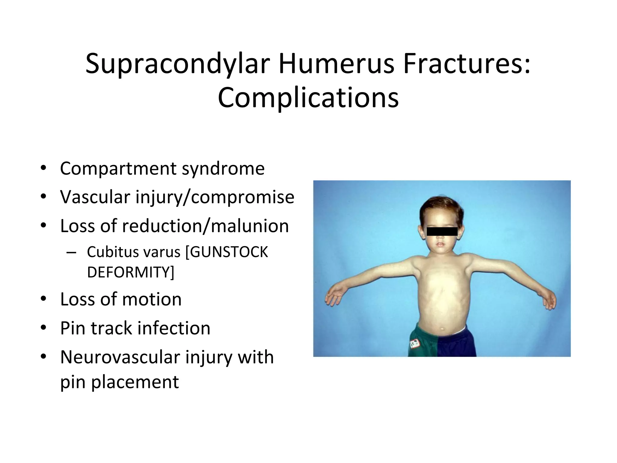 Classificaton-of-injuries-around-elbow-management-of-supracondylar ...