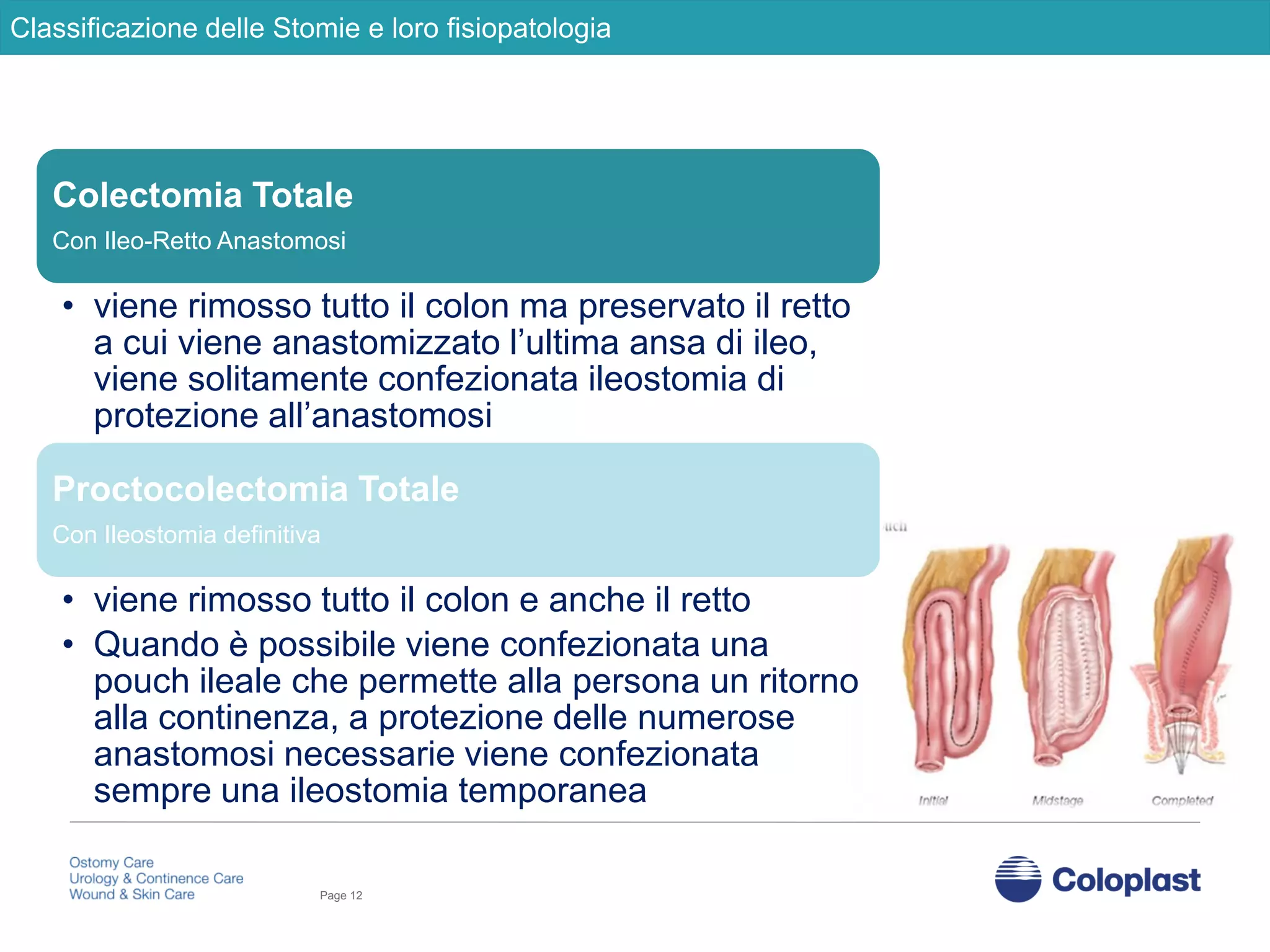 Classificazione delle stomie e loro fisiopatologia - Corso Stomaterapia ...