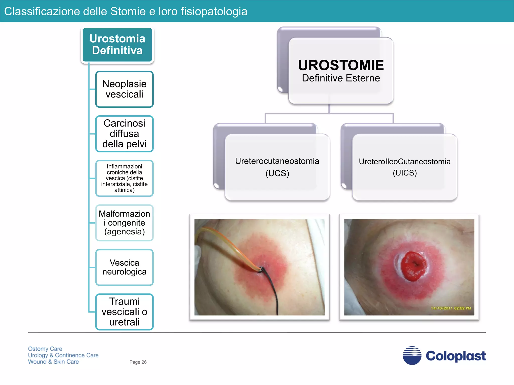 Classificazione delle stomie e loro fisiopatologia - Corso Stomaterapia di base - Firenze 8-9.05 ...