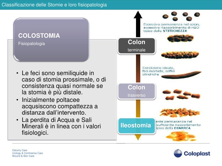 Classificazione delle stomie e loro fisiopatologia - Corso Stomaterap…