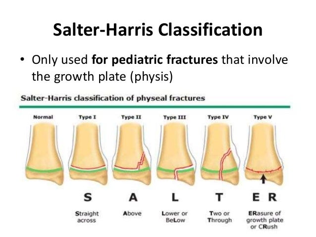 Classification of Fractures & Compound Fracture Managment