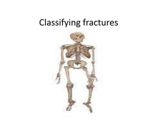 Classifying fractures | PPTX