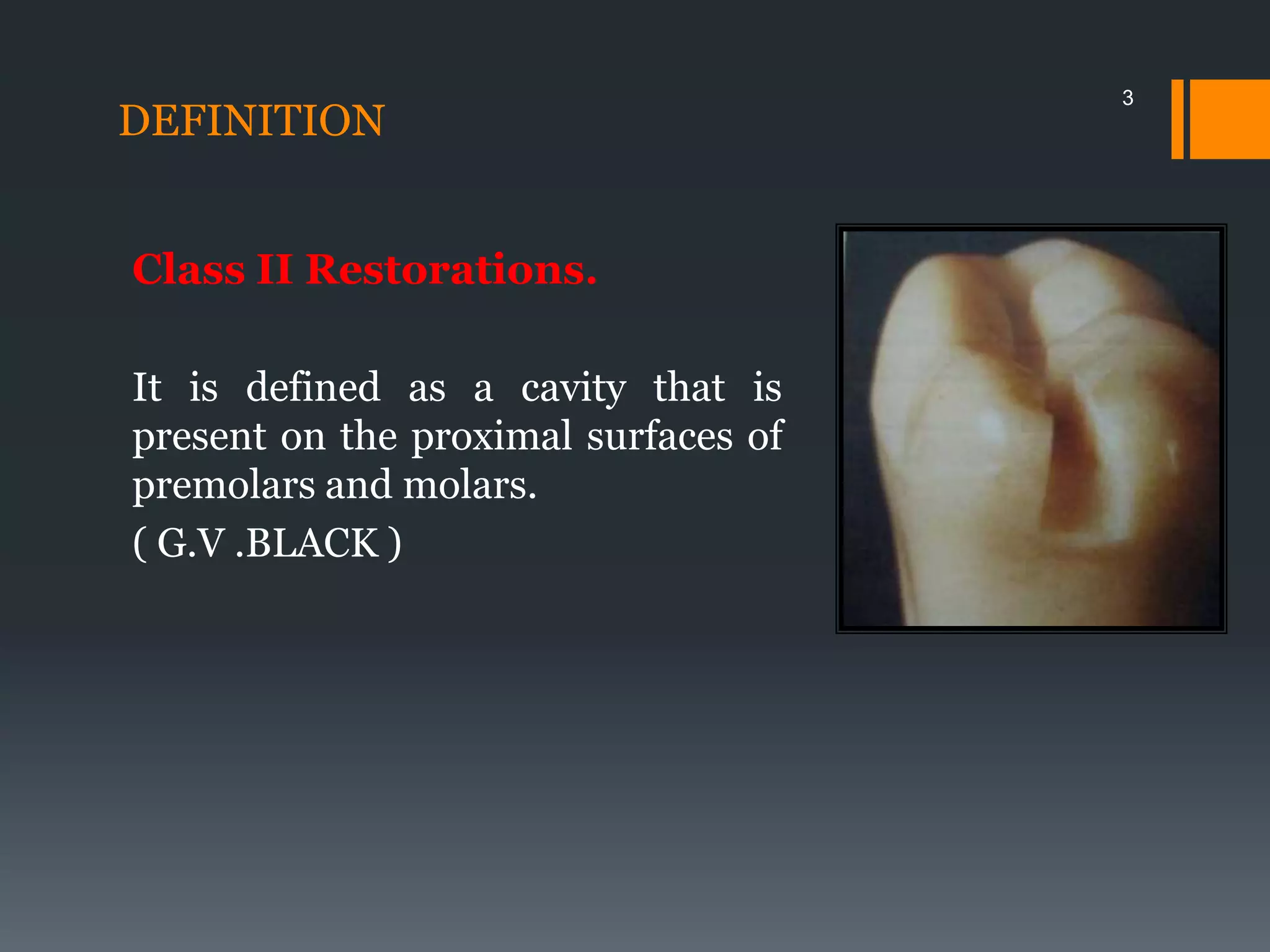 Class ii amalgam | PPTX