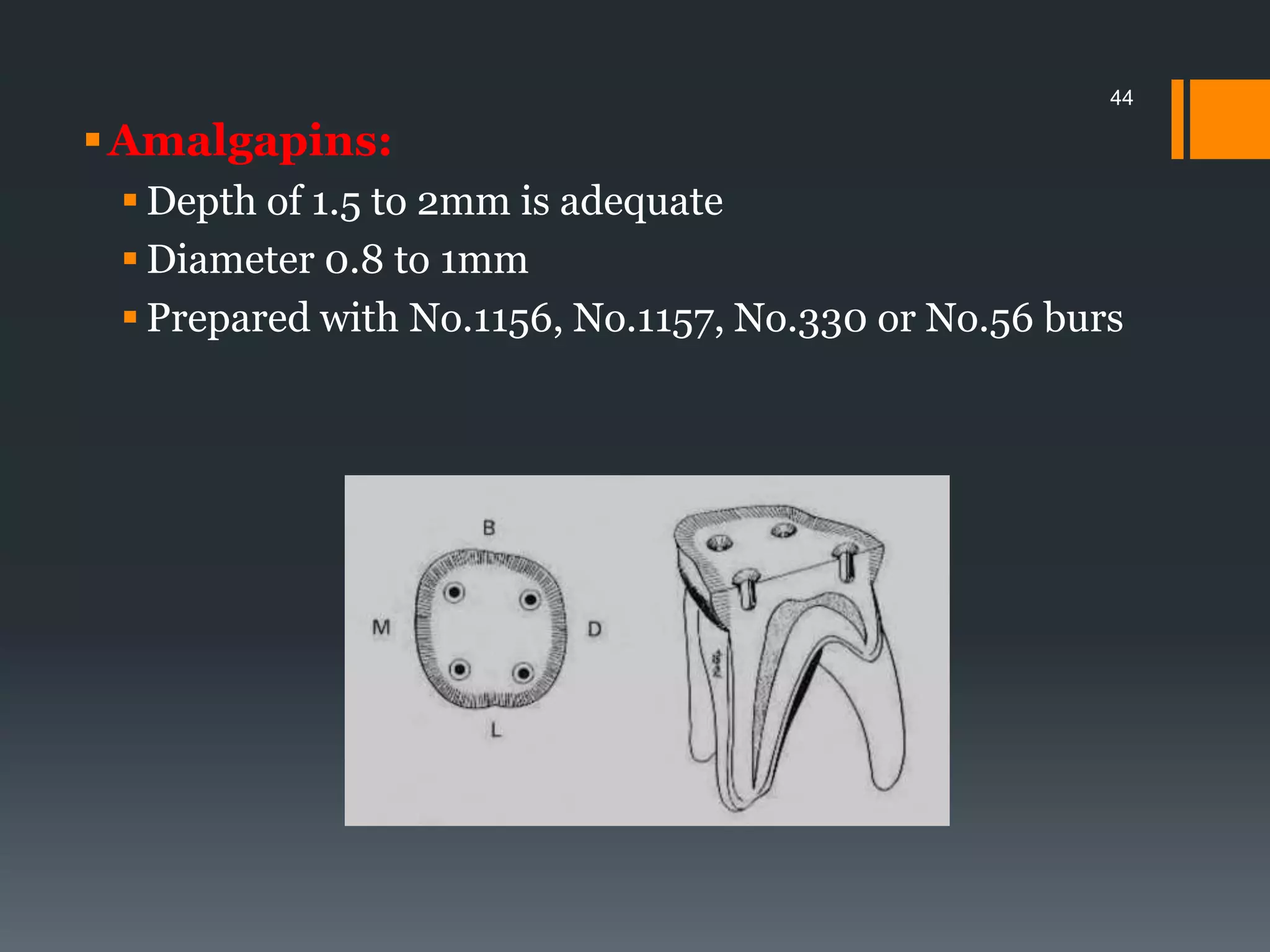 Class ii amalgam | PPTX