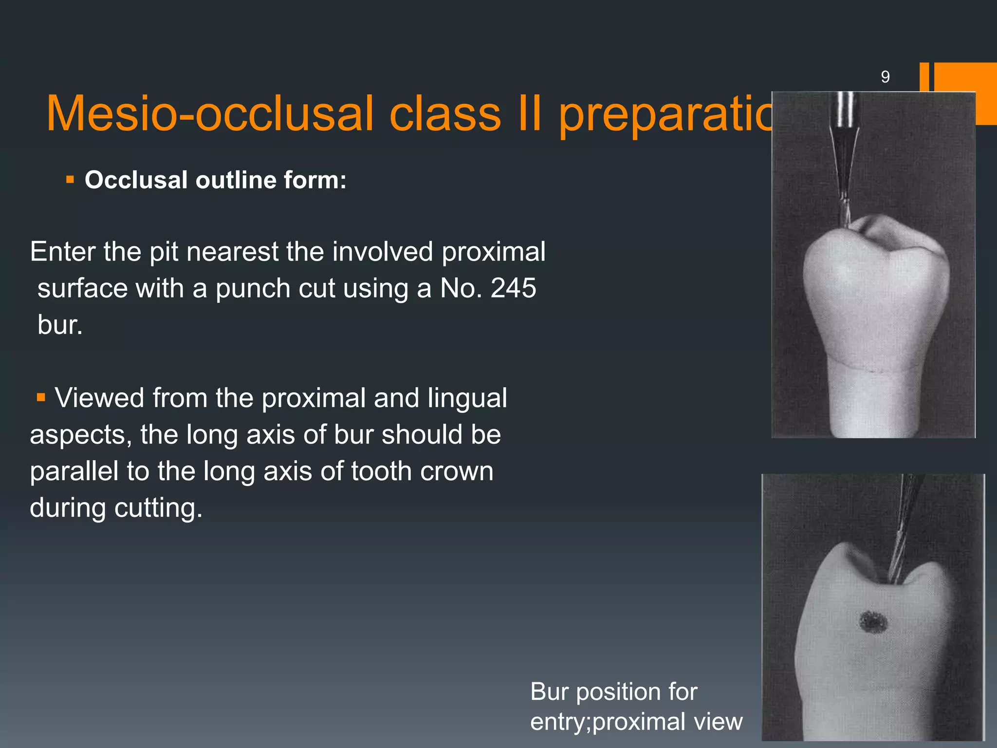Class ii amalgam | PPTX
