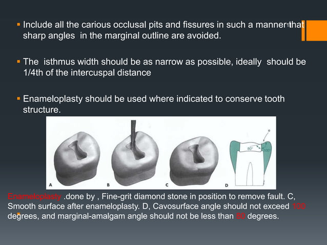 Class ii amalgam | PPTX | Dental Health | Diseases and Conditions