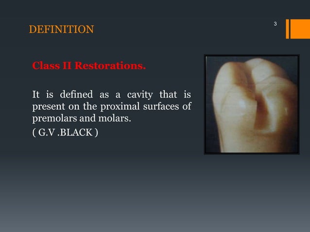 Class ii amalgam | PPTX | Dental Health | Diseases and Conditions