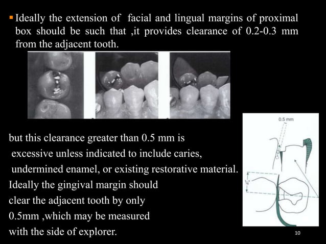 Class II amalgam | PPTX