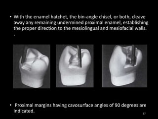 Class II amalgam | PPTX