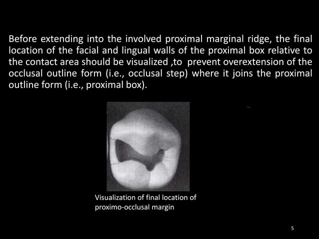 Class II amalgam | PPTX
