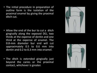 Class II amalgam | PPTX