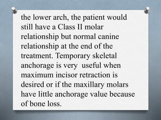 Class II Malocclusion (Camouflage Treatment) | PPTX