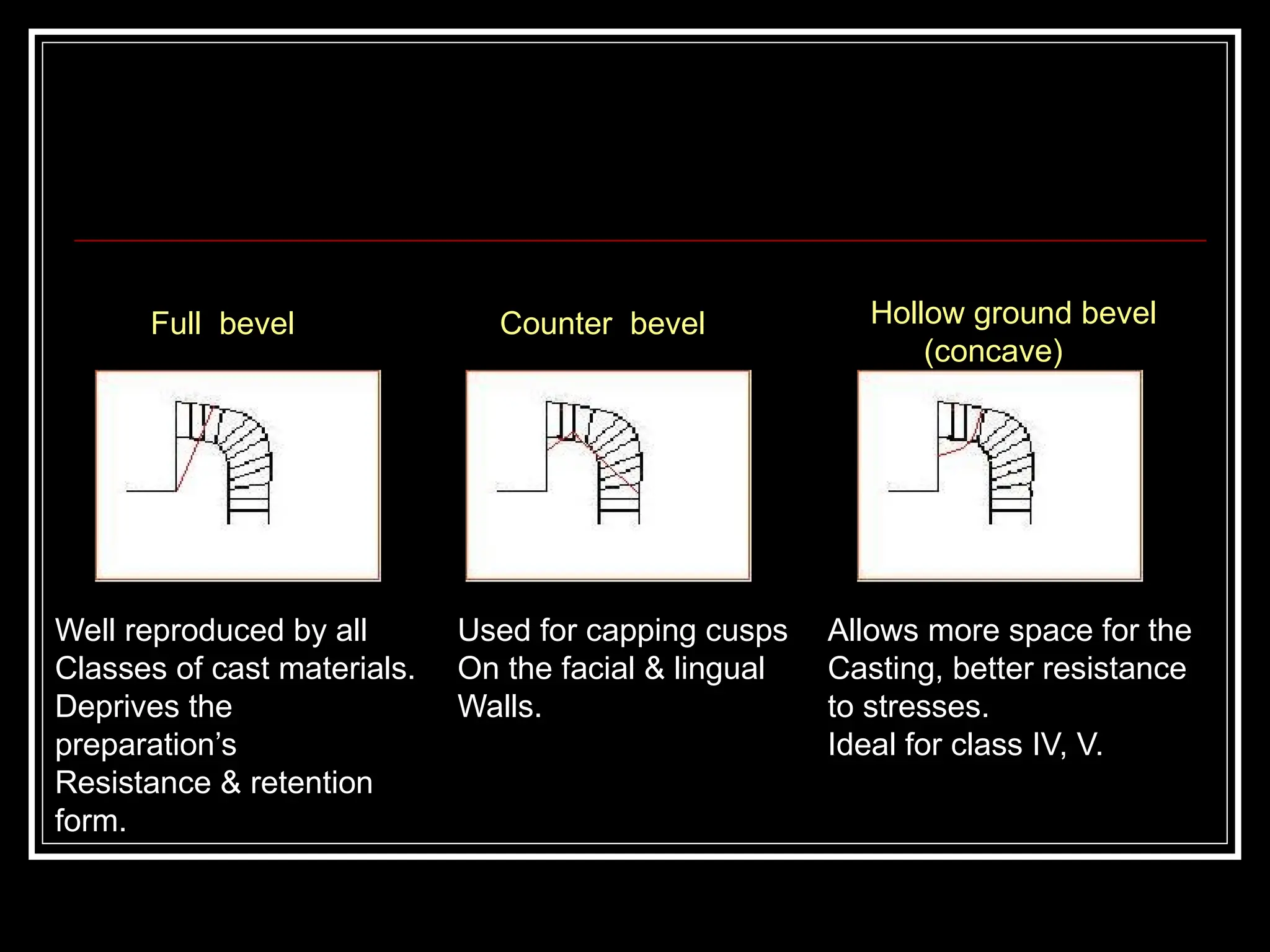 CLASS II CAST METAL RESTORATIONS.powerpoint | PPTX