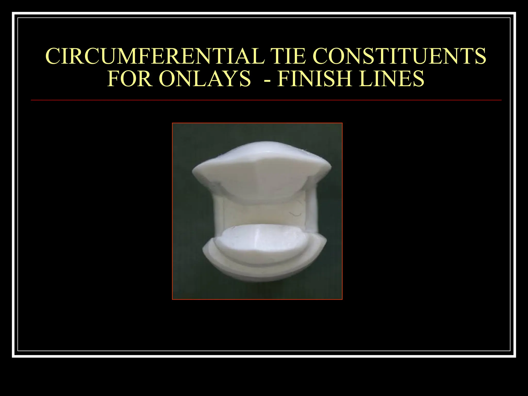 CLASS II CAST METAL RESTORATIONS.powerpoint | PPTX