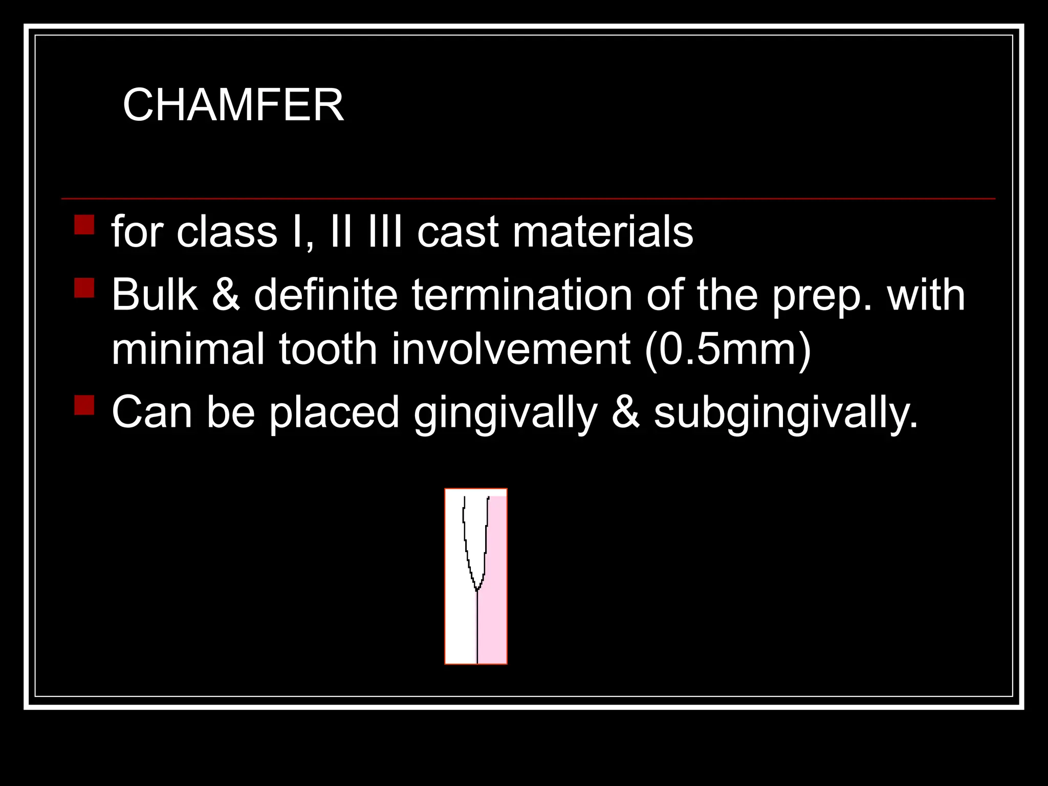 CLASS II CAST METAL RESTORATIONS.powerpoint | PPTX