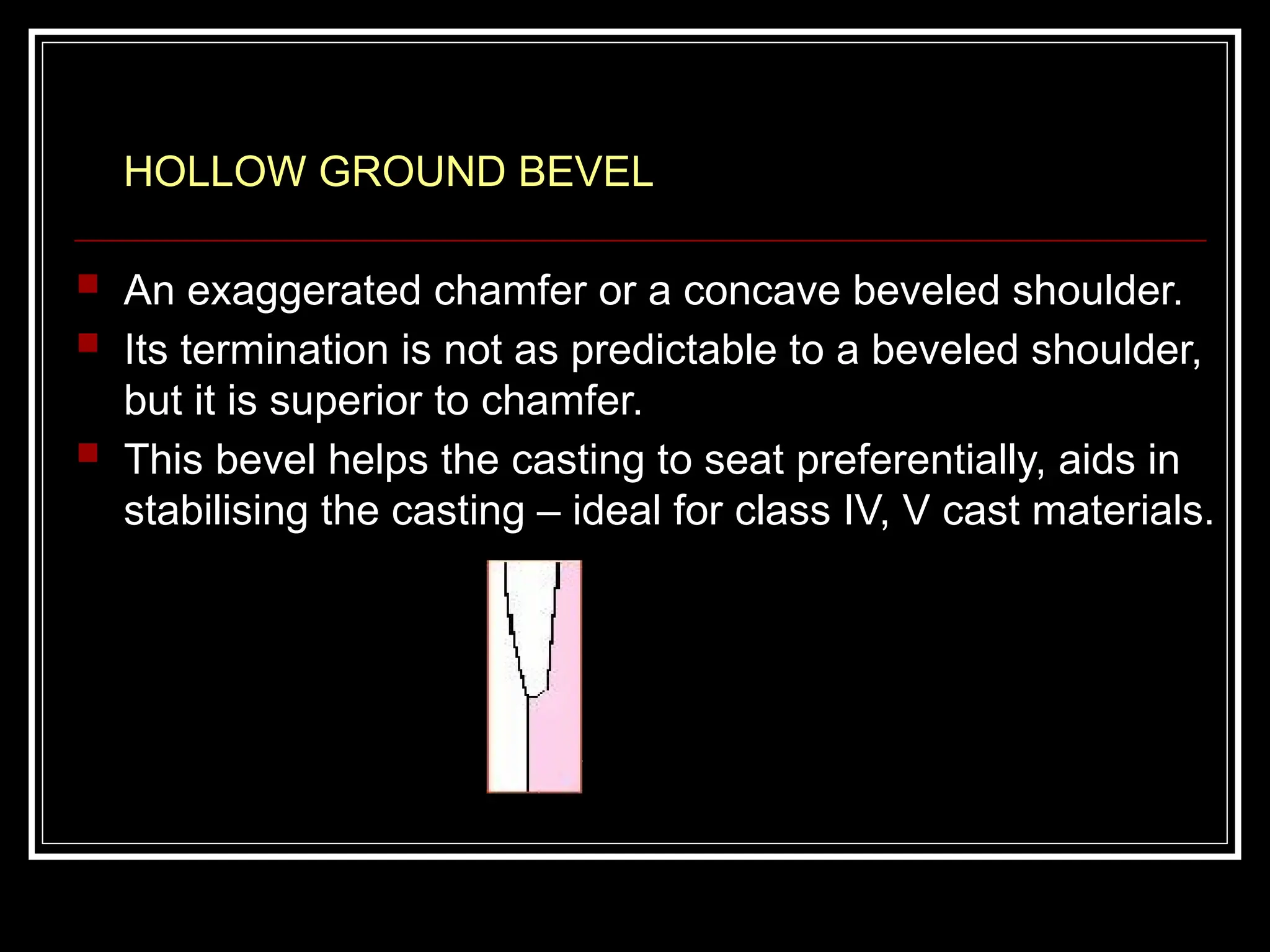 CLASS II CAST METAL RESTORATIONS.powerpoint | PPTX