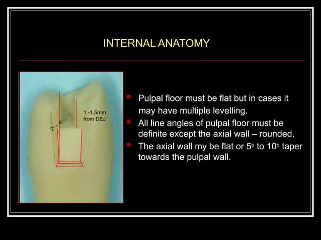 CLASS II CAST METAL RESTORATIONS.powerpoint | PPTX | Dental Health ...