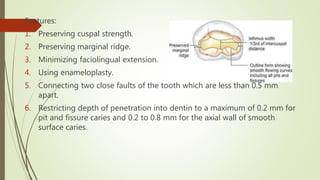 Class II cavity preparation | PPTX