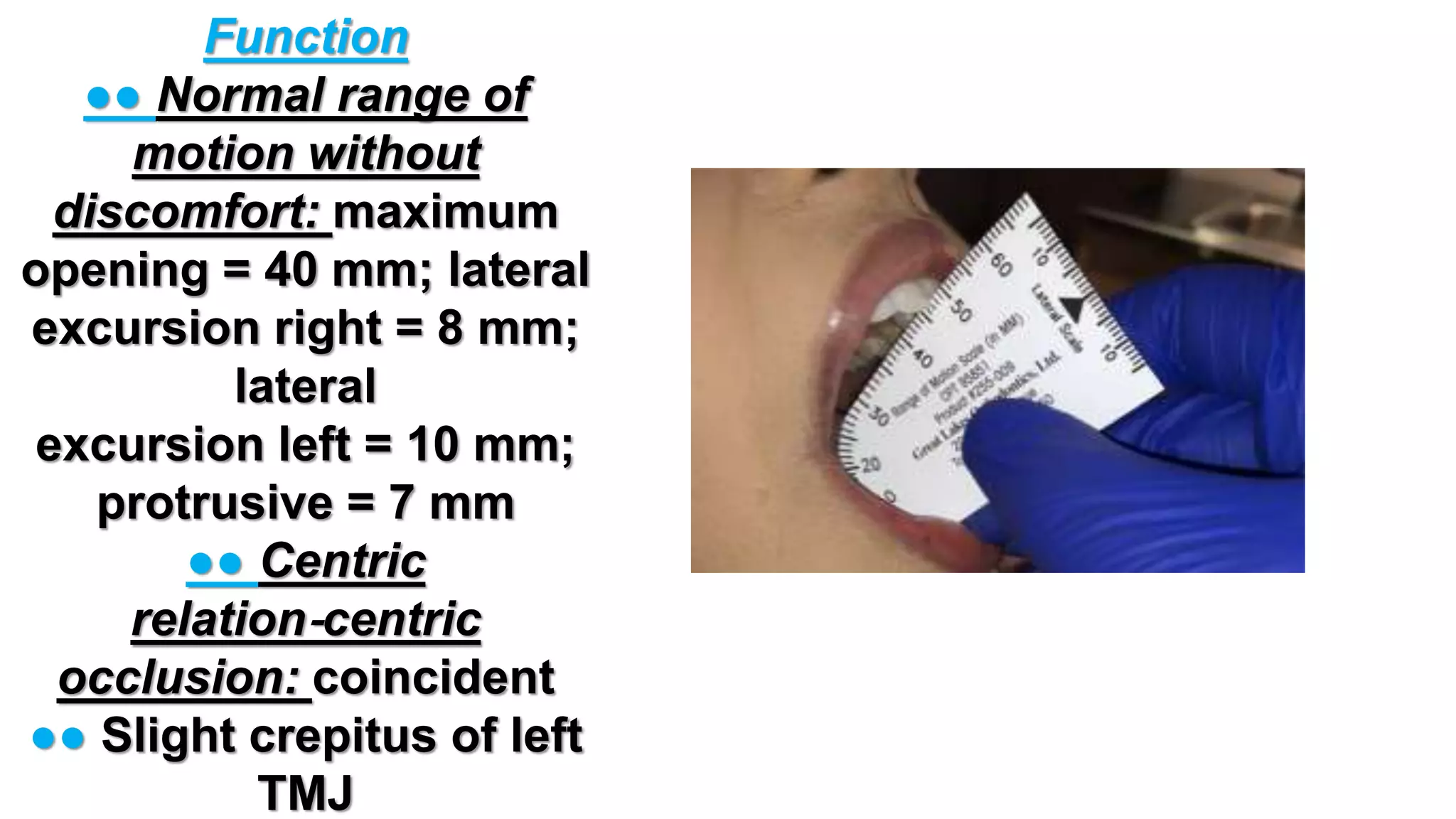 orthodontic correction of class II div 1 extraction of 4 bicuspids | PPTX