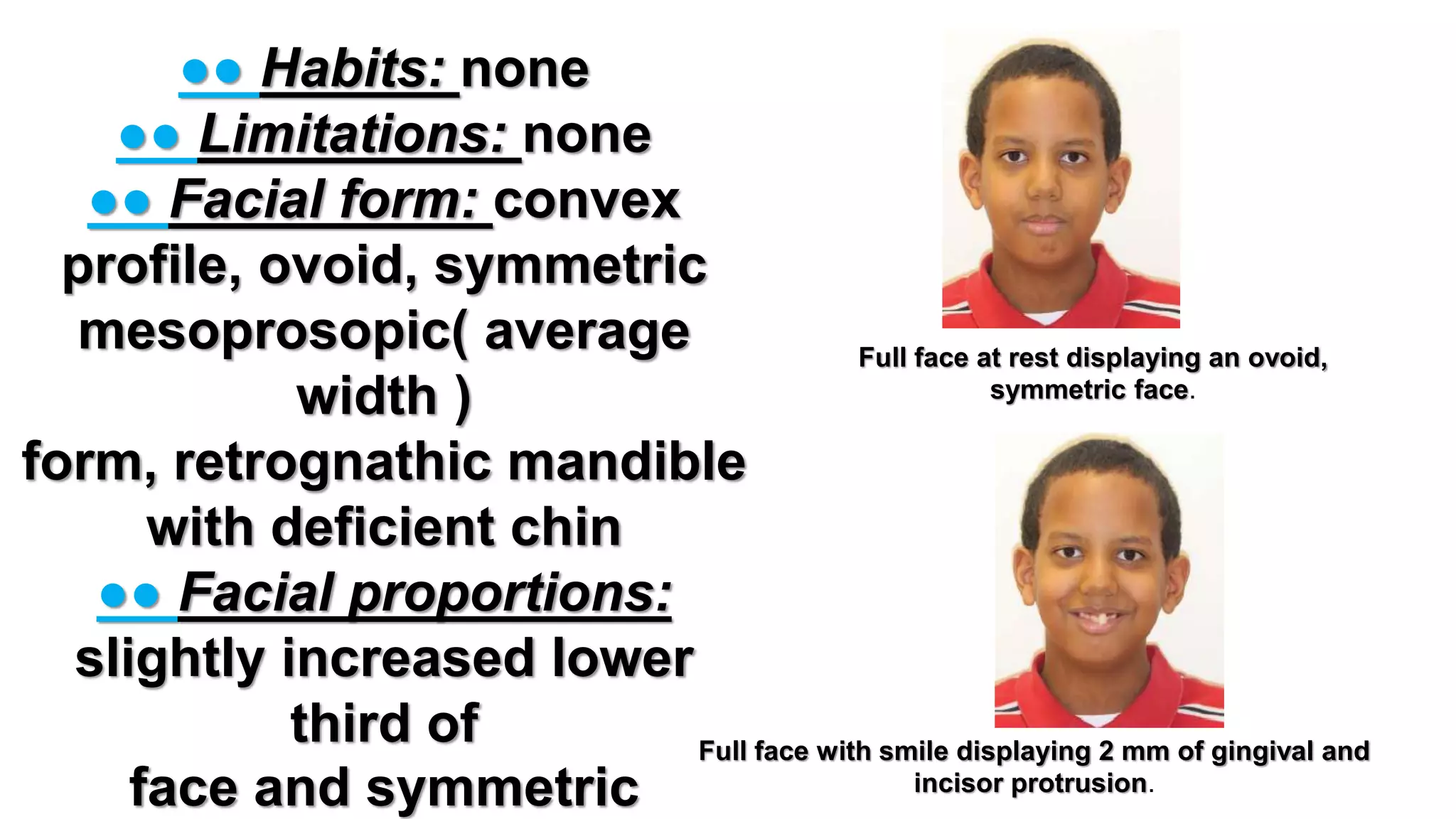 orthodontic correction of class II div 1 extraction of 4 bicuspids | PPTX