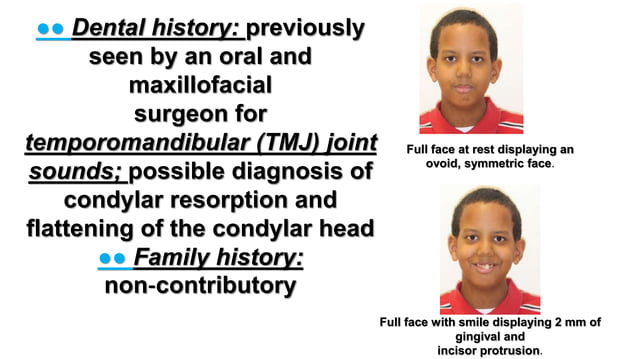 orthodontic correction of class II div 1 extraction of 4 bicuspids | PPTX