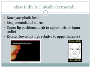 Class ii div 2 | PPTX