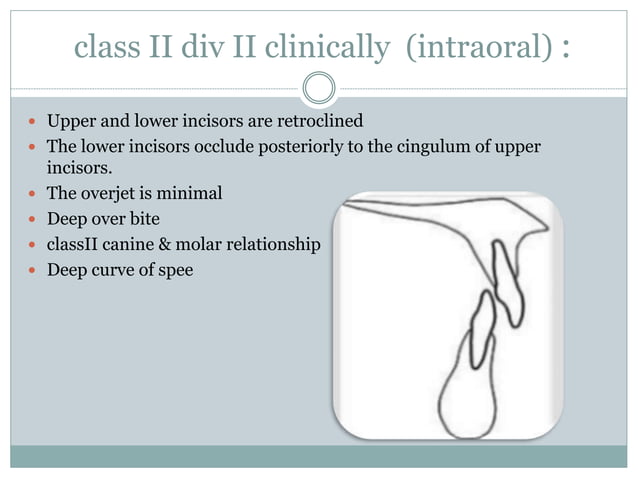 Class ii div 2 | PPTX | Dental Health | Diseases and Conditions